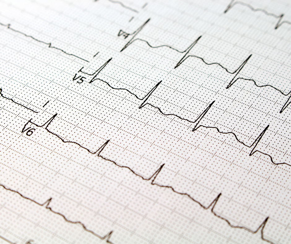 Inspanningstest met ECG en ademgasanalyse - Sportgeneeskunde Midden ...